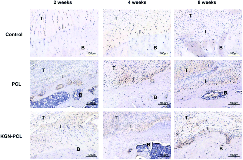 Enhancement of rotator cuff tendon–bone healing using combined aligned ...