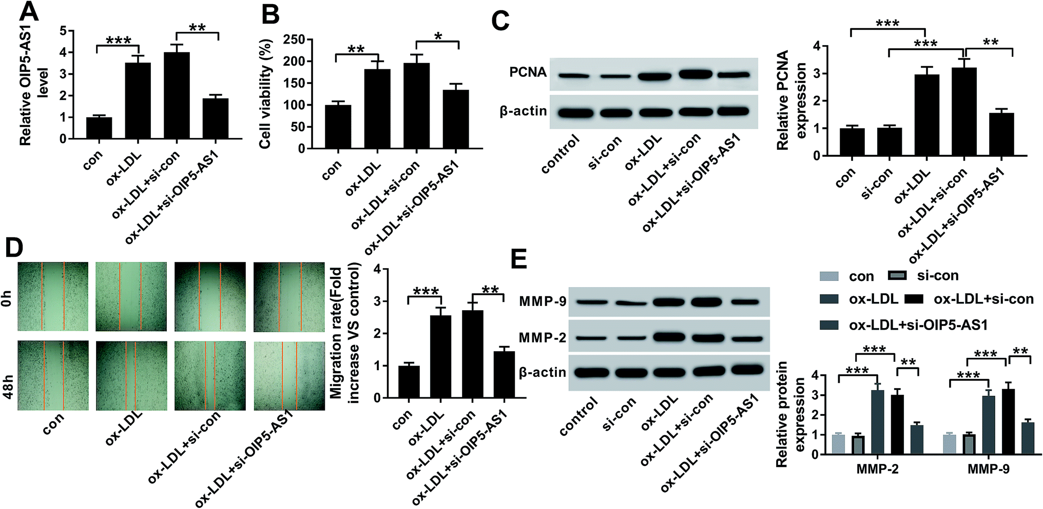 Retracted Article Knockdown Of Long Non Coding Rna Oip5 As1 Suppresses