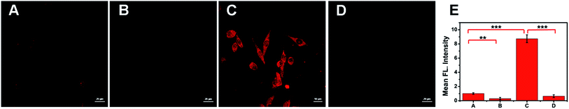 In situ visualization of ozone in the brains of mice with depression phenotypes by using a new ...