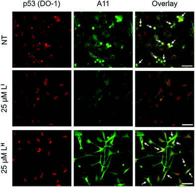 Bifunctional ligand design for modulating mutant p53 aggregation in ...