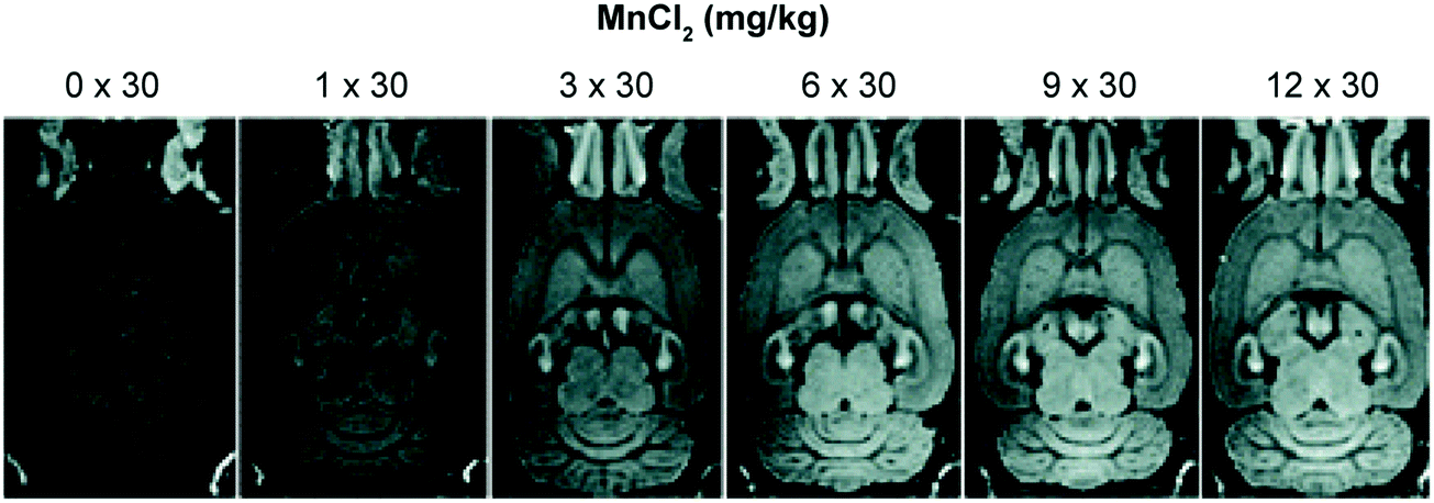 Metal-based imaging agents: progress towards interrogating ...