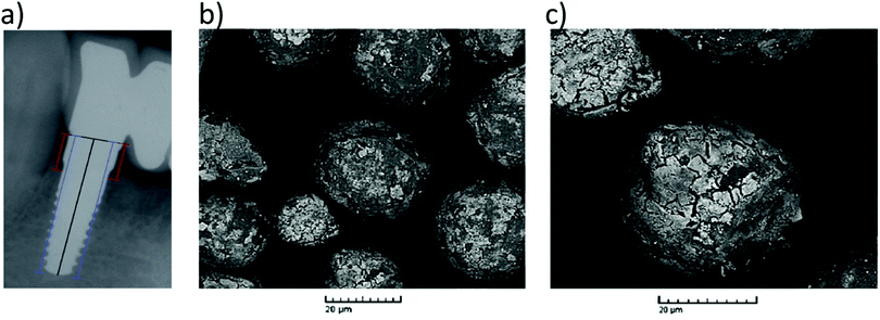 The use of yttrium in medical imaging and therapy: historical ...