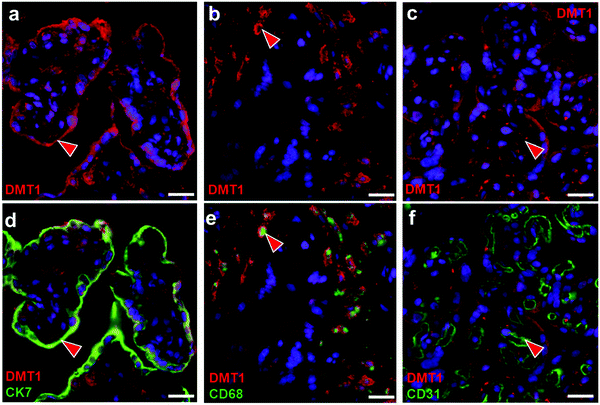 Human placental cell line HTR-8/SVneo accumulates cadmium by divalent ...