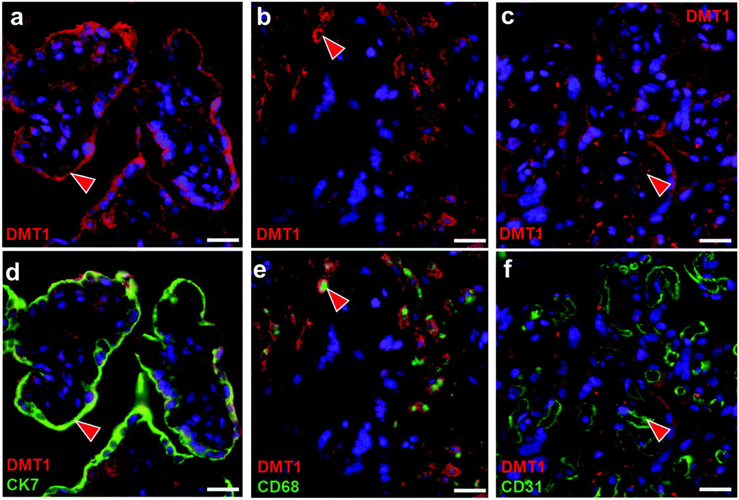 Human placental cell line HTR-8/SVneo accumulates cadmium by divalent ...