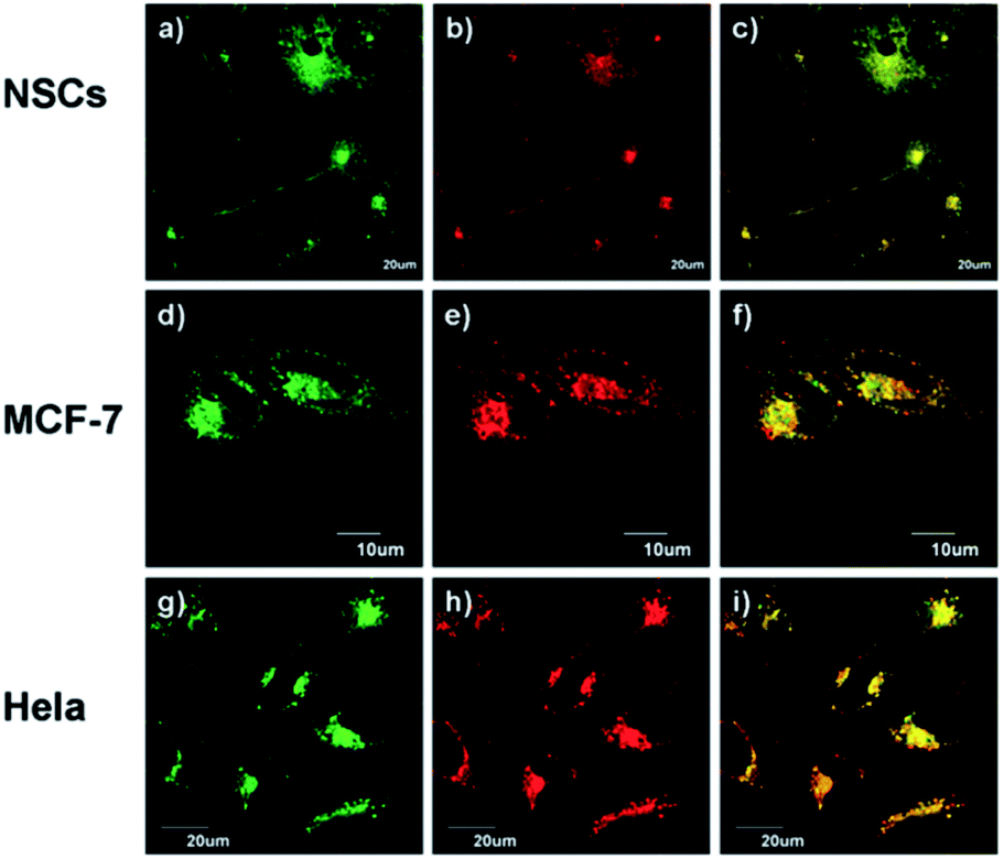 Subcellular localised small molecule fluorescent probes to image mobile ...