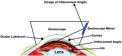 Ophthalmic sensing technologies for ocular disease diagnostics ...