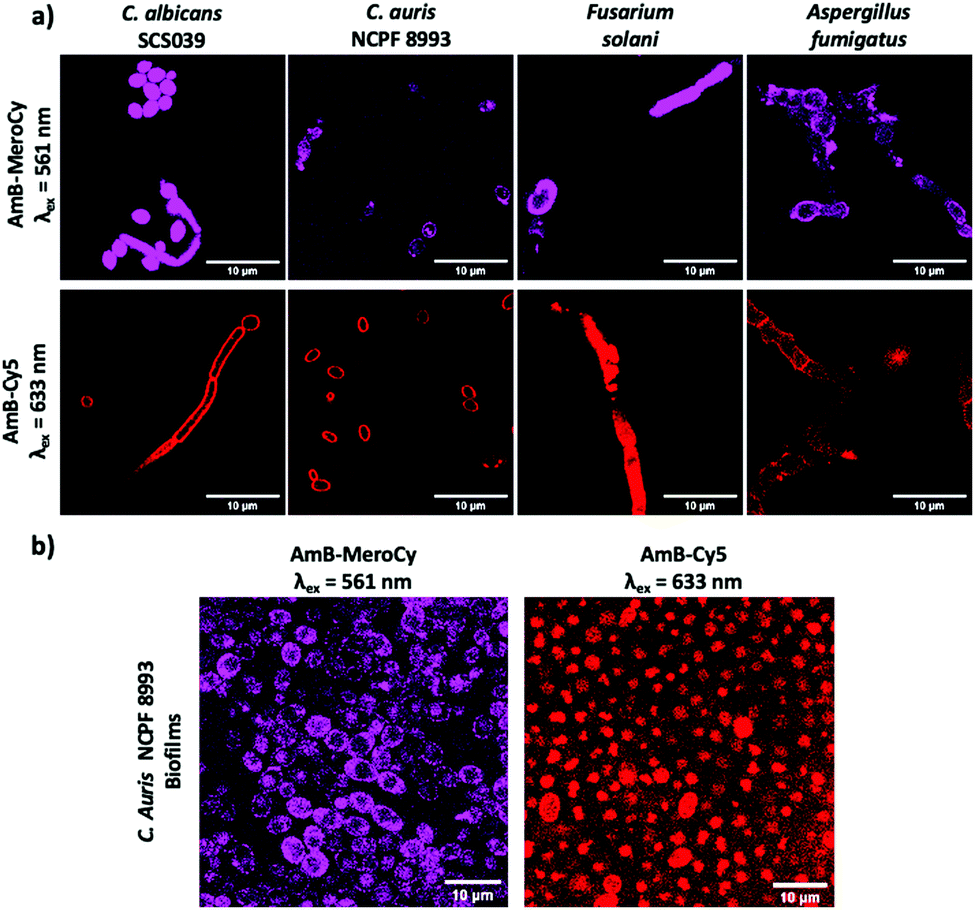 Dyeing fungi: amphotericin B based fluorescent probes for multiplexed ...