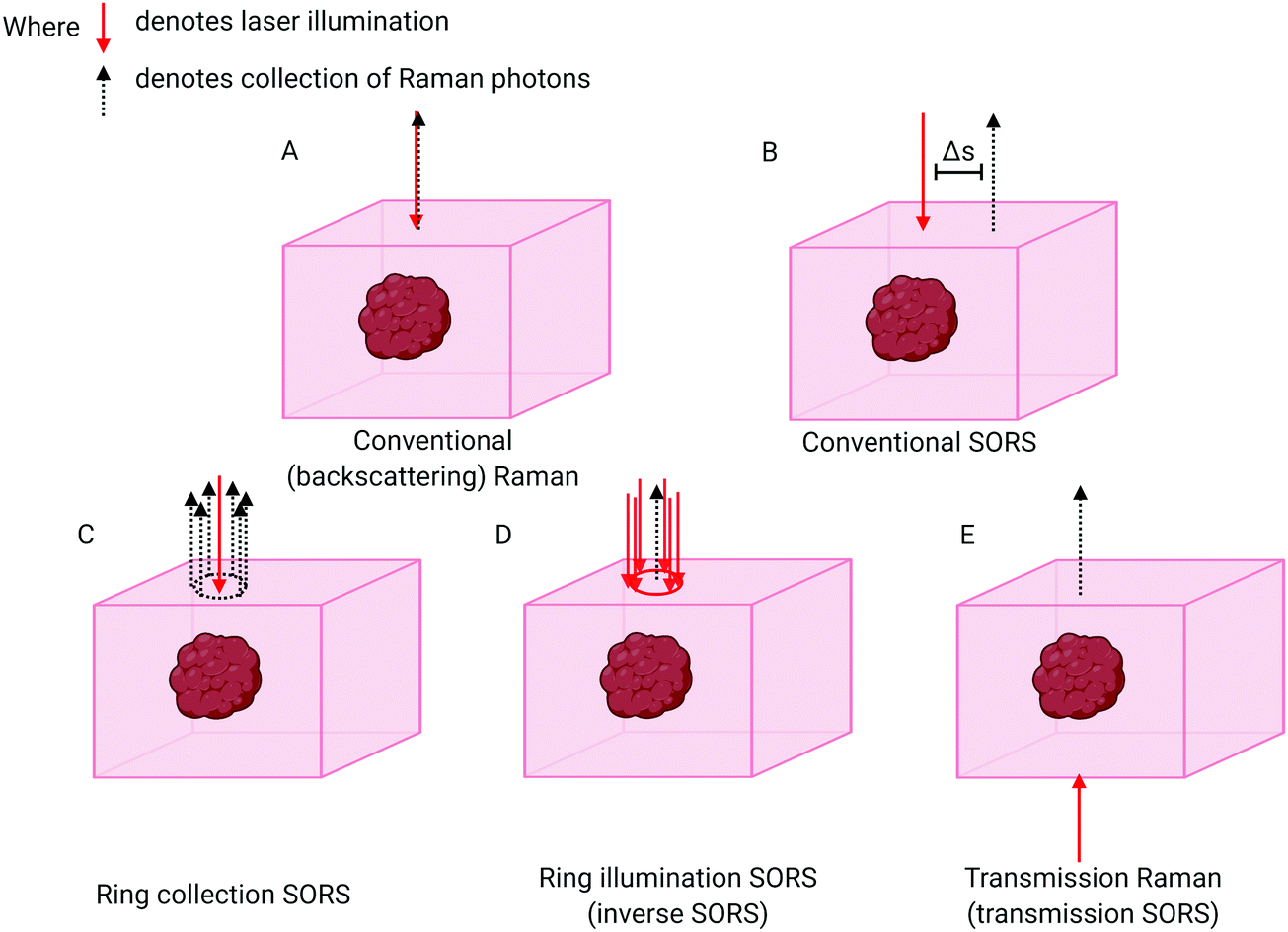 Spatially offset Raman spectroscopy for biomedical applications - Chemical Society Reviews (RSC ...