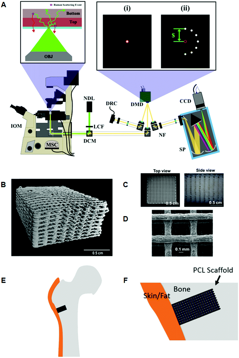 Spatially offset Raman spectroscopy for biomedical applications ...