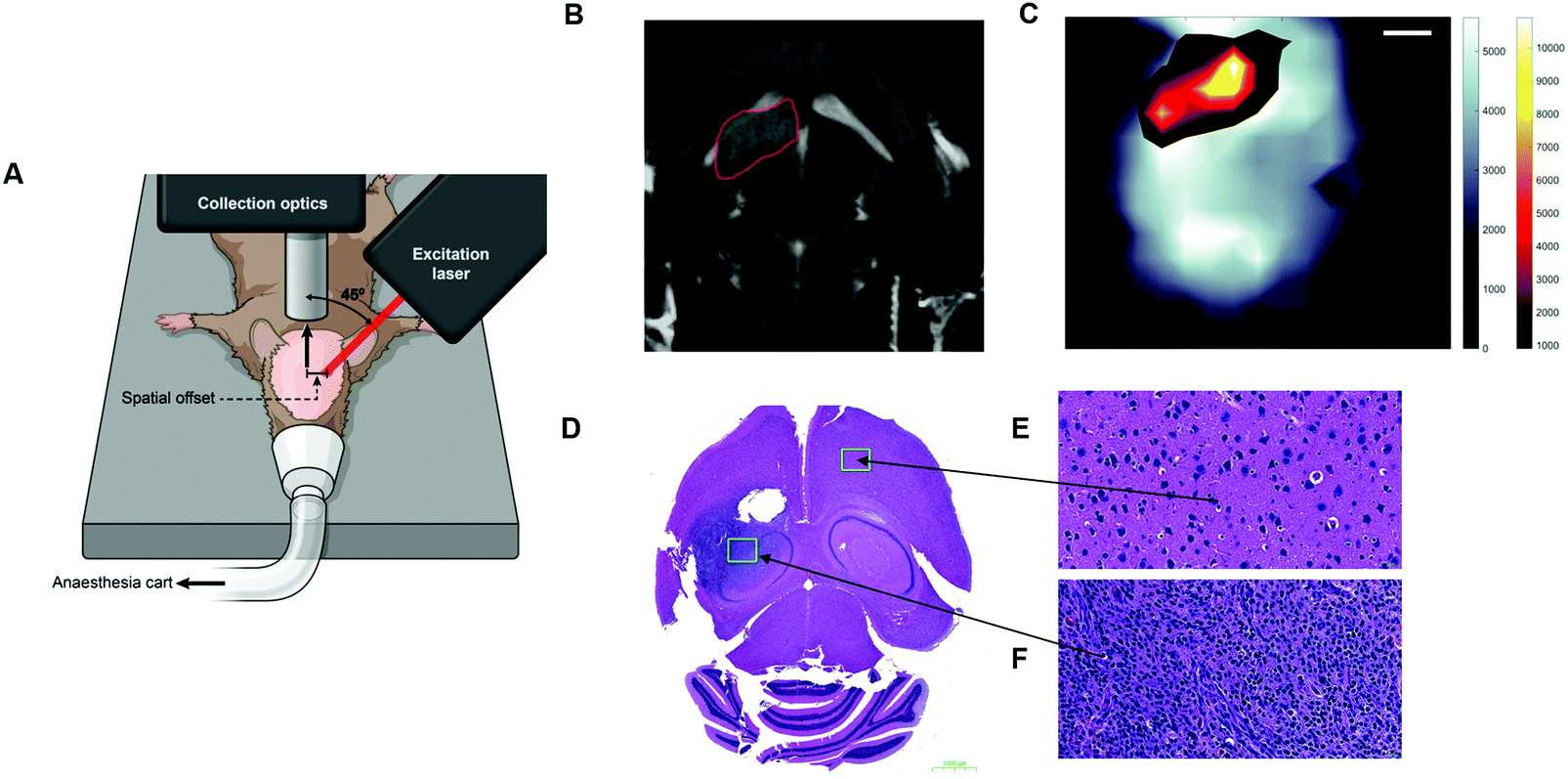 Spatially offset Raman spectroscopy for biomedical applications ...