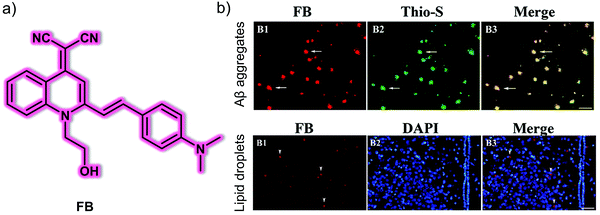 Small-molecule fluorescence-based probes for interrogating major organ ...