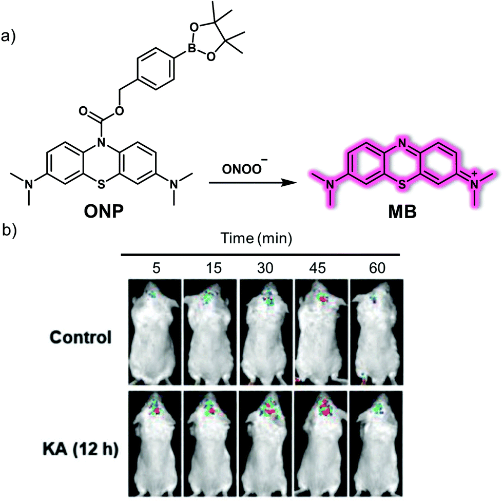 Small-molecule fluorescence-based probes for interrogating major organ ...