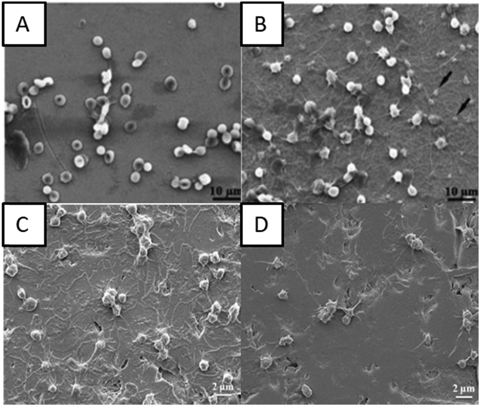 Surface modification strategies to improve titanium hemocompatibility ...