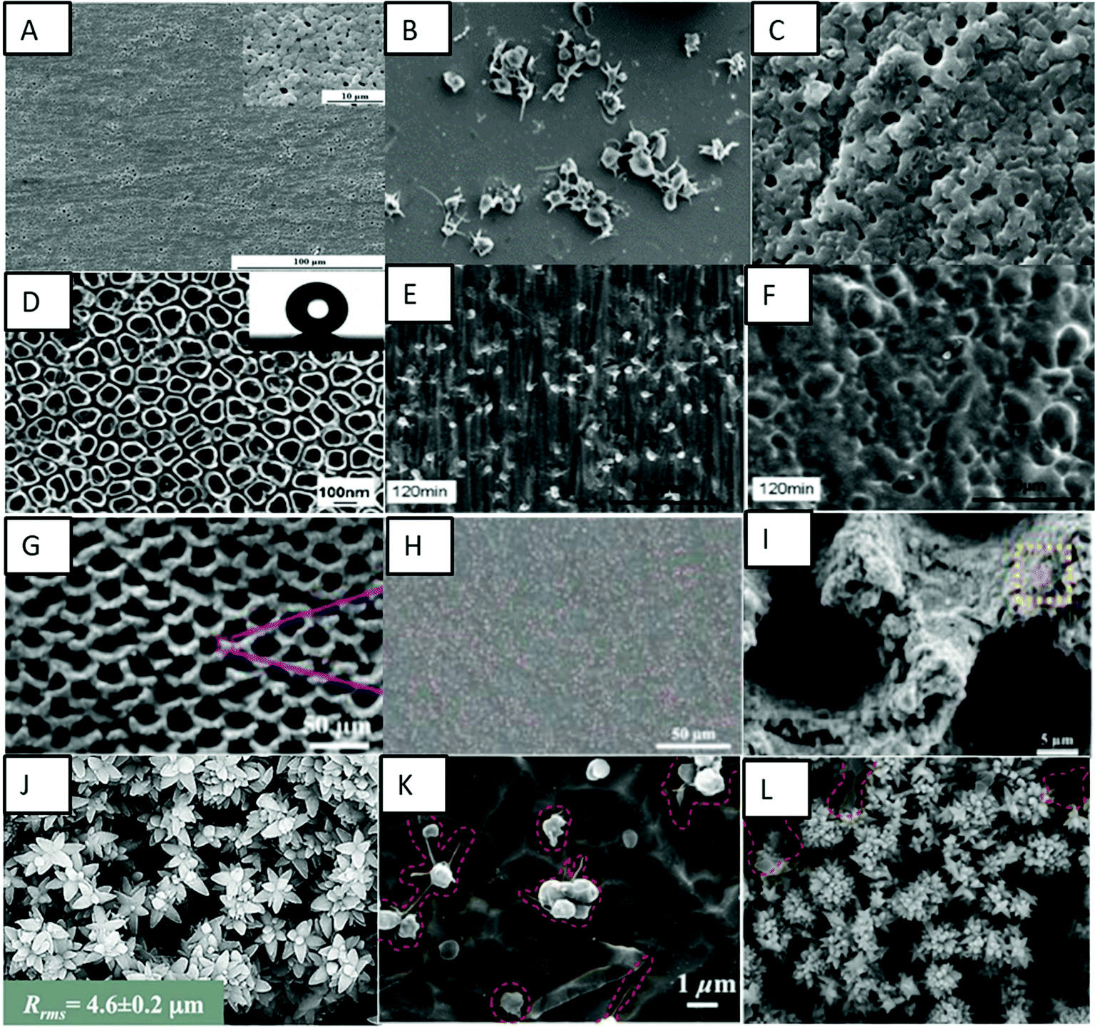Surface modification strategies to improve titanium hemocompatibility ...