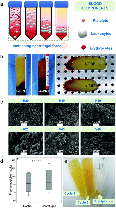 Blood apheresis technologies – a critical review on challenges towards ...