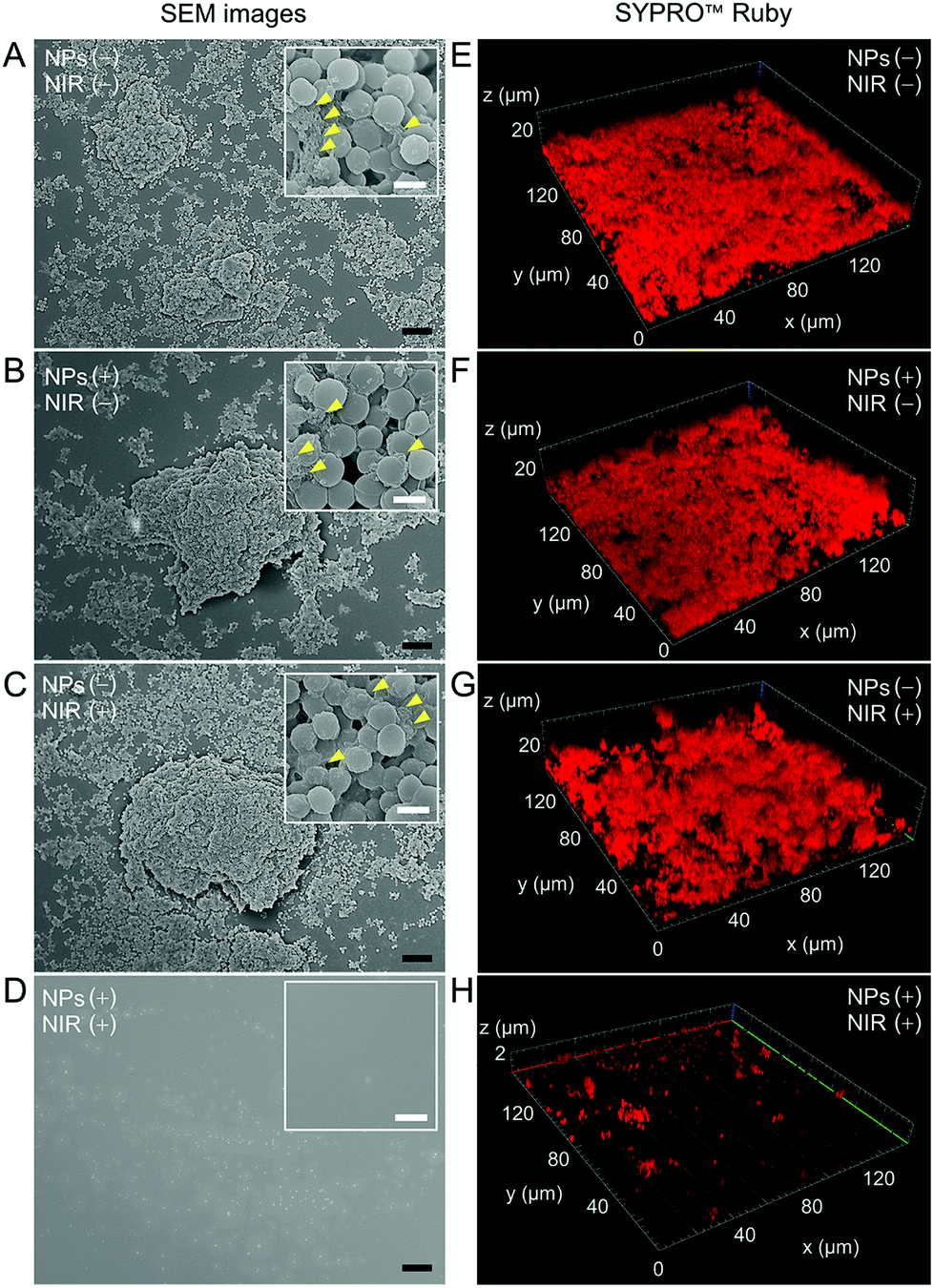 Highly efficient photothermal nanoparticles for the rapid eradication ...