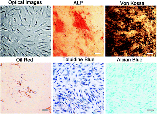 Enhanced regeneration of bone defects using sintered porous Ti6Al4V ...