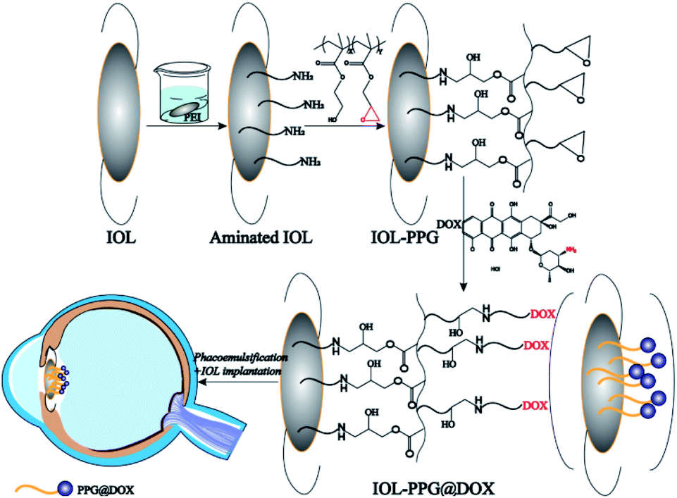 Facile multifunctional IOL surface modification via poly(PEGMA- co -GMA ...