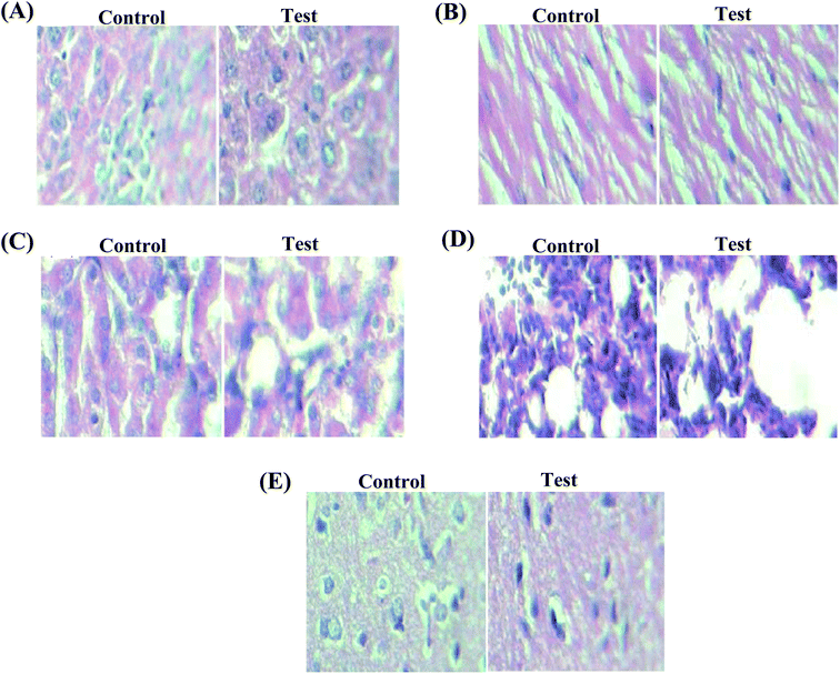 Ghatti gum-base graft copolymer: a plausible platform for pH-controlled ...