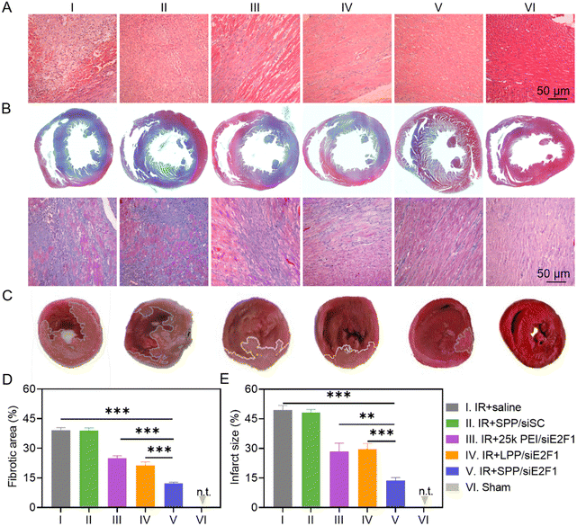 Spherical α-helical polypeptide-mediated E2F1 silencing against ...