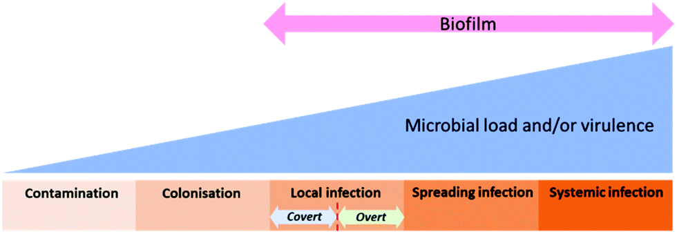 Local Vs Systemic Infection
