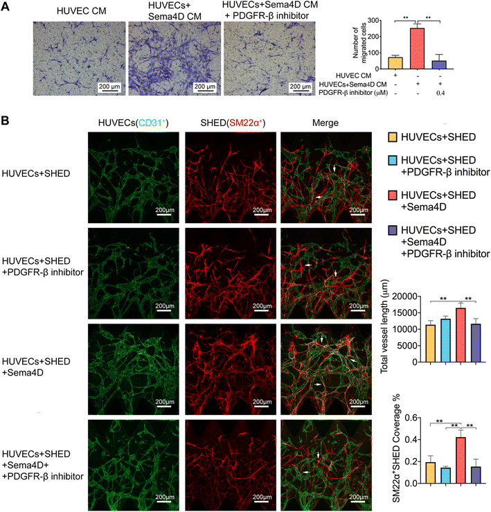 Sema4D–plexin-B1 signaling in recruiting dental stem cells for vascular ...