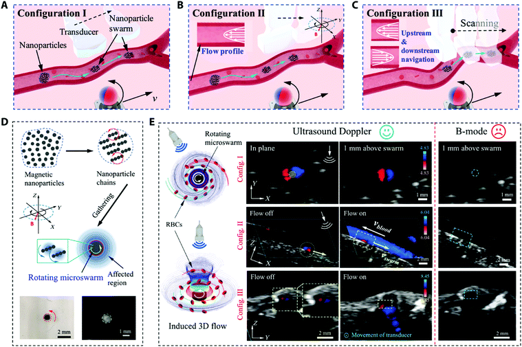 Recent trends of contrast agents in ultrasound imaging: a review of the ...