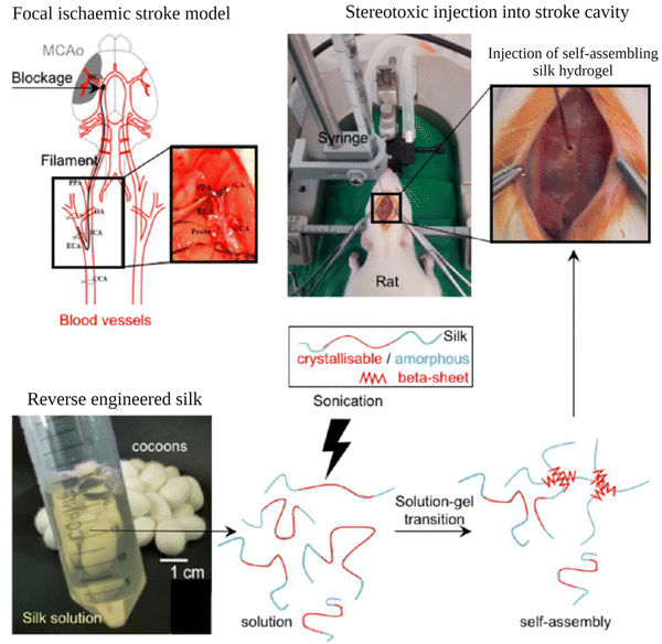 Self-assembled silk fibroin hydrogels: from preparation to biomedical ...