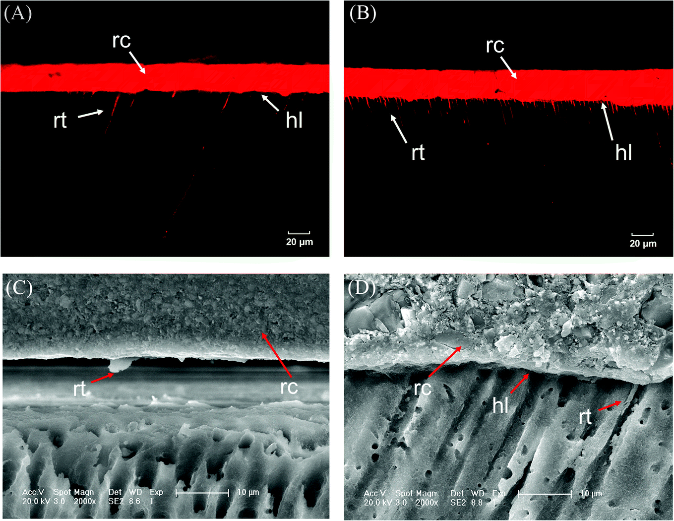 A novel resin cement to improve bonding interface durability - RSC ...