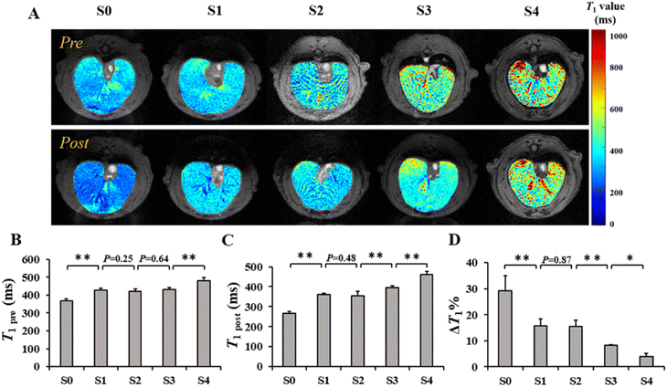 T 1 – T 2 dual-modal magnetic resonance contrast-enhanced imaging for ...