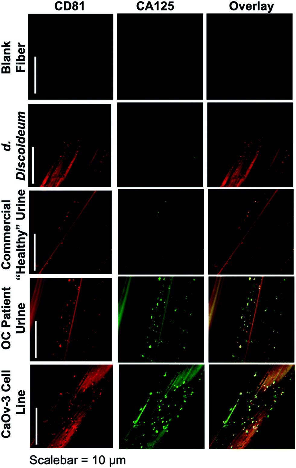 Facile, generic capture and on-fiber differentiation of exosomes via ...