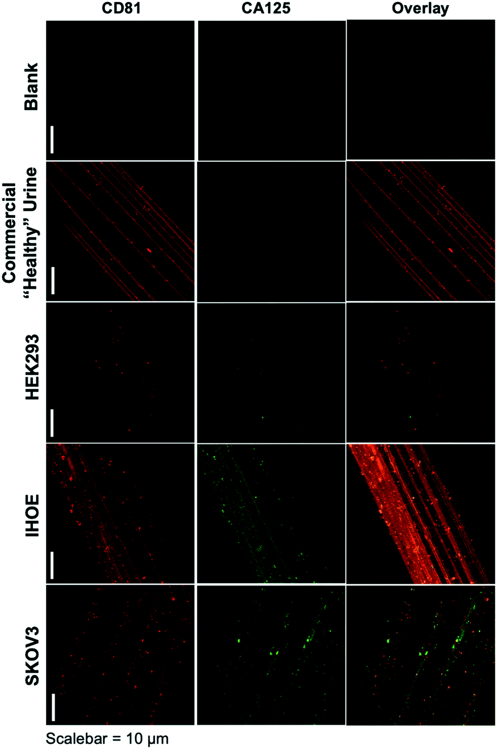 Facile, generic capture and on-fiber differentiation of exosomes via ...