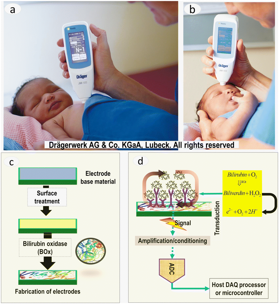 70 years of bilirubin sensing: towards the point-of-care bilirubin ...