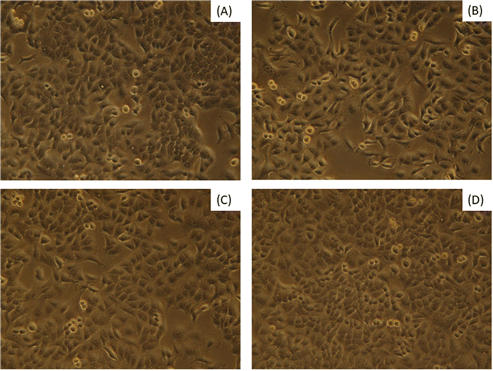 Biomedical competency of bassanite (plaster of Paris) synthesized from ...