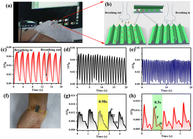 Recent progress in flexible micro-pressure sensors for wearable health ...