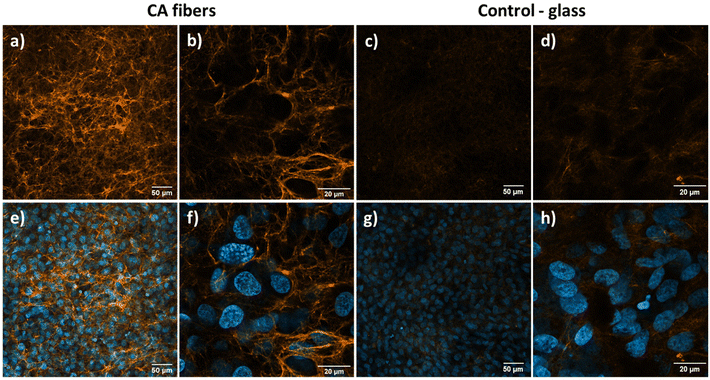 Mimicking natural electrical environment with cellulose acetate ...