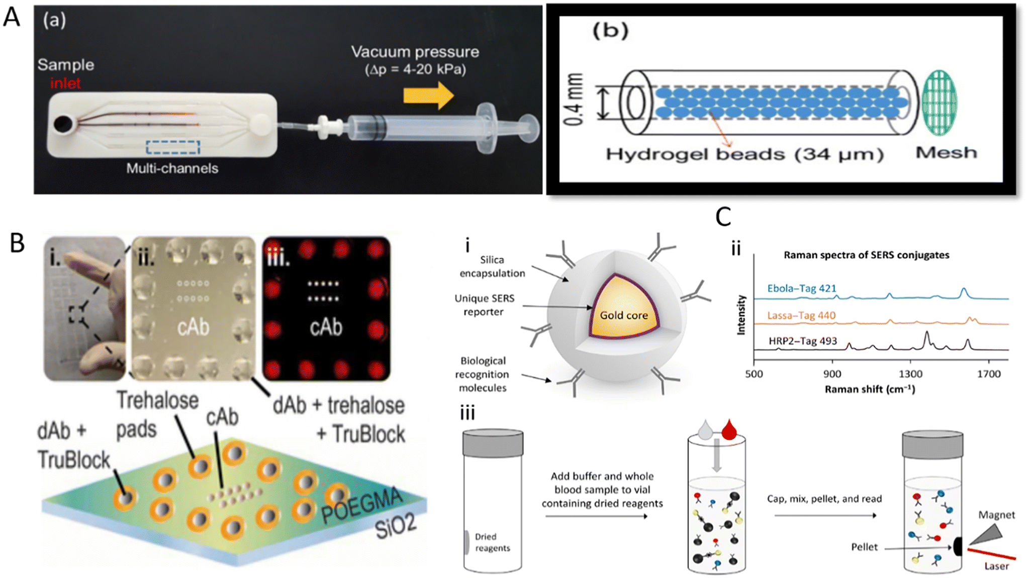 Point-of-care testing of infectious diseases: recent advances - Sensors ...