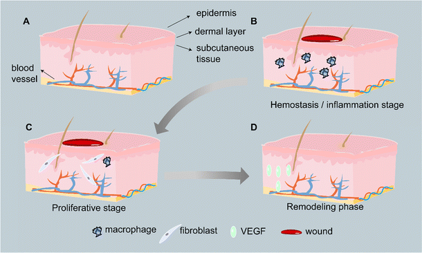 Smart microneedle patches for wound healing and management - Journal of ...