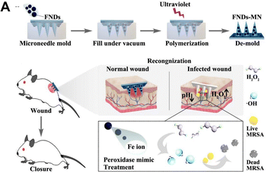 Smart microneedle patches for wound healing and management - Journal of ...
