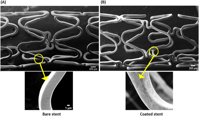 Nanogold-coated stent facilitated non-invasive photothermal ablation of ...