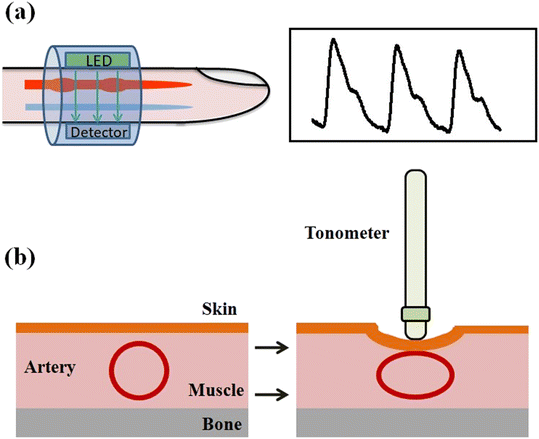 Blood pressure measurement techniques, standards, technologies, and the ...