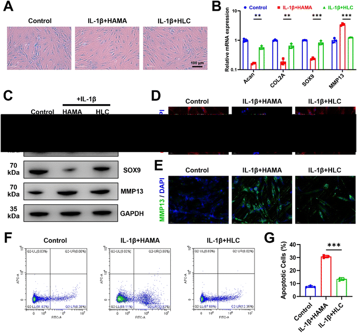 Cyaonoside A-loaded composite hydrogel microspheres to treat ...