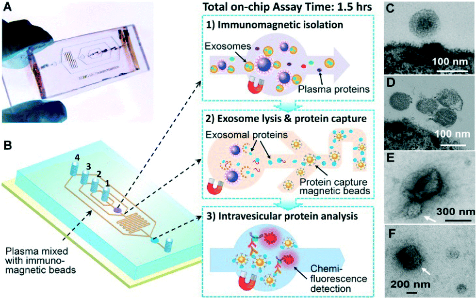 New 'lab-on-a-chip' could revolutionize early diagnosis of cancer ...