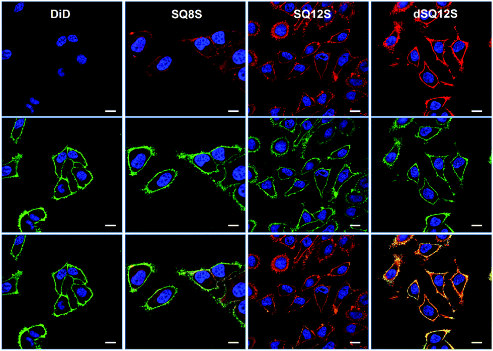 Bright fluorogenic squaraines with tuned cell entry for selective ...