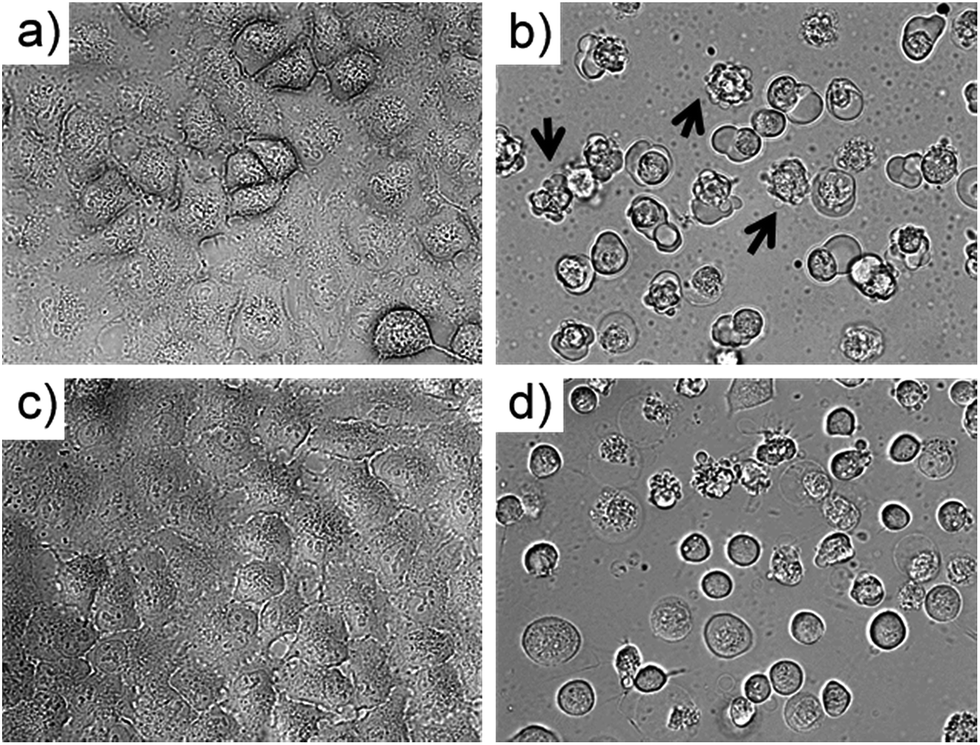 Green light-induced apoptosis in cancer cells by a tetrapyridyl ...